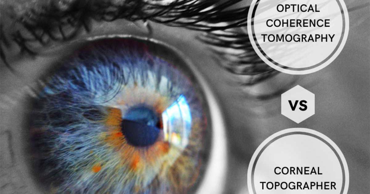 An O.D.’s Playbook: Optical Coherence Tomography Versus Corneal ...